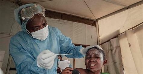 엠폭스 비상사태관련주 상한가 직행