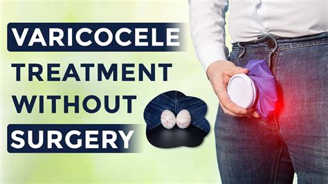 Varicocele Treatment Without Surgery Report Review Varicocele