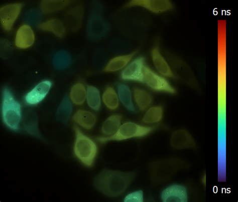 Fluorescence Lifetime Imaging