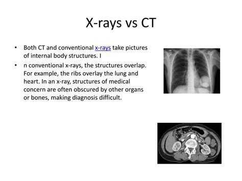Ppt Ct Scanning Powerpoint Presentation Free Download Id2149188
