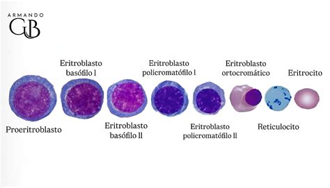 Armando Gb 🩸🔬clasificaciÓn General De Las Anemias Con Base En El Vcm