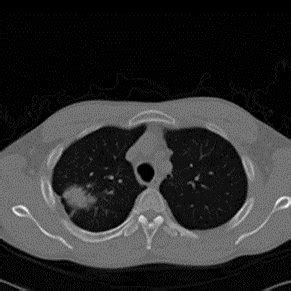 Chart Illustrated Accuracy Sensitivity And Specification Of Proposed Download Scientific