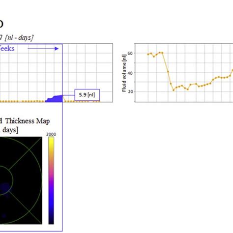 Graphs Showing The Results Of Agreement Between The Notal OCT Analyzer