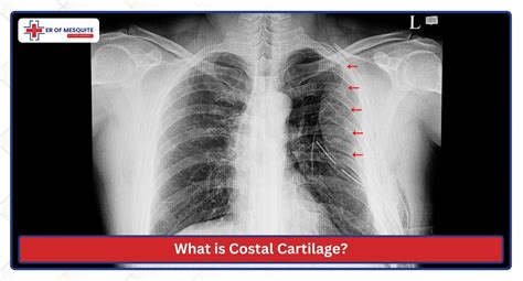 Study The Anatomy Of Costal Cartilage Location And Function