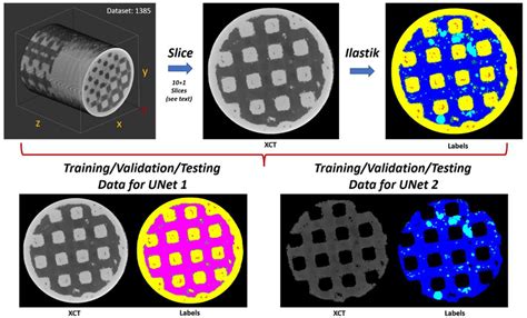 Trainingvalidationtesting Data For The Two Unets Labels Bone Dark