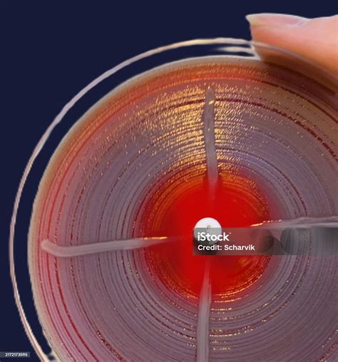 Penicillinsensitive Staphylococcus Aureus Can Be Treated With Penicillin Because They Dont