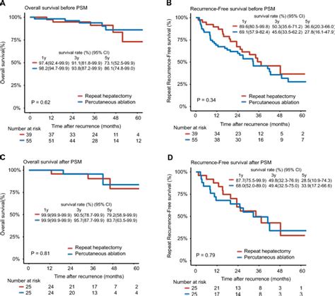 Repeat Hepatectomy Versus Percutaneous Ablation For Recurrent Hepatocellular Carcinoma Emphasis