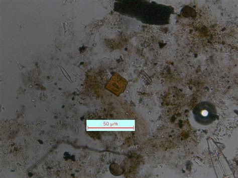 Tmi Smear Slides Tags