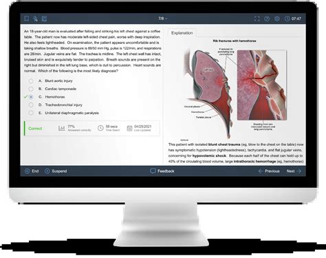 Usmle Step 2 Ck Practice Questions And Exams