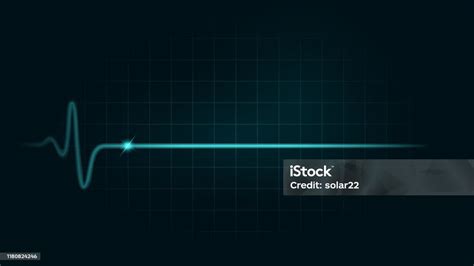 모니터의 녹색 차트 배경에 죽은 동안 펄스 속도 라인 심부전에 대한 그림 맥박 추적에 대한 스톡 벡터 아트 및 기타 이미지