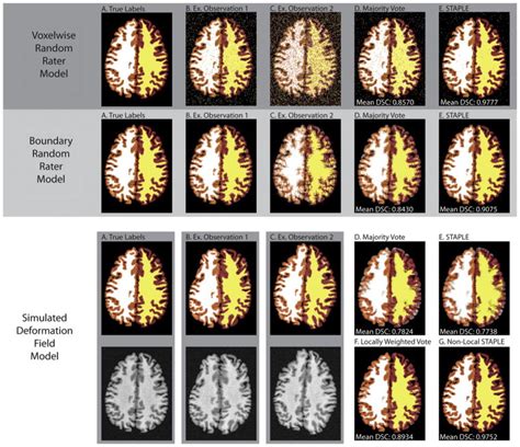 non local statistical label fusion for multi atlas segmentation