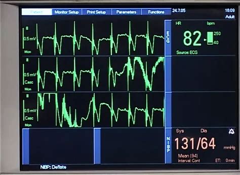 Doctor Gay Porn Videos Xhamster