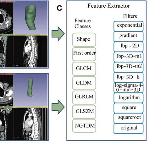 A B Image Acquisition And Tumor Segmentation A The Region Of