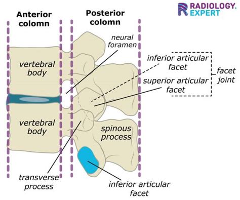 MRI Lumbar Spine