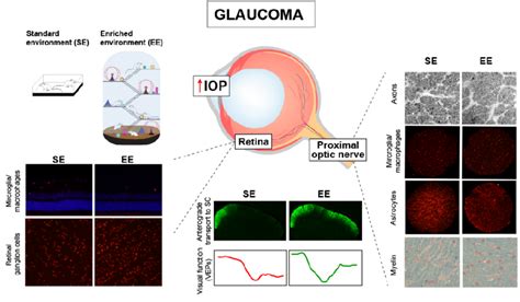 Effect Of The Enriched Environment Ee On Experimental Glaucoma Download Scientific Diagram