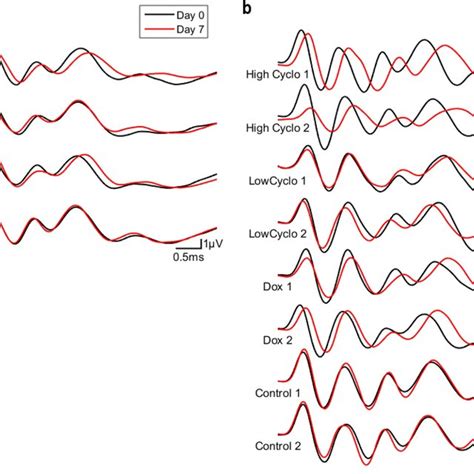 Example Of Abr Waveforms Stacked By Sound Level With Peaks And Troughs Download Scientific