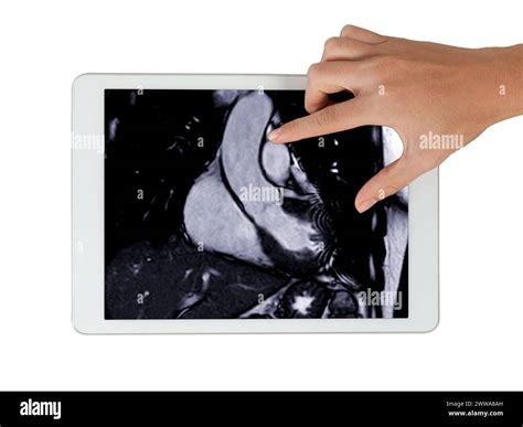Cardiac Mri Imaging Cut Out Stock Images And Pictures Alamy