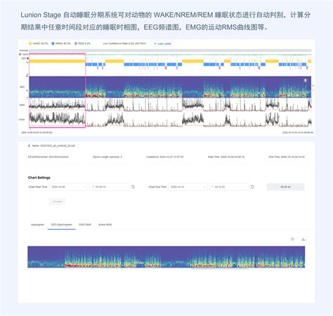 【脑科学】谷氨酸能神经元对小鼠nrem睡眠的控制作用 知乎