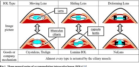 Table 1 From Artificial Accommodating Intraocular Lens Powered By An Ion Polymer Metal Composite