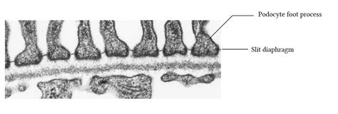 Structure And Function Of The Glomerulus Deranged Physiology