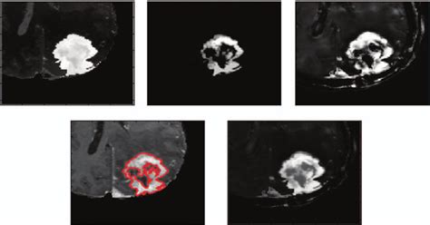 Examples Of Confidence Maps The First Row Shows Confidence Maps Of Gc Download Scientific
