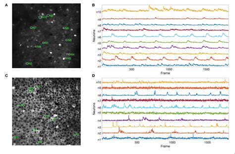 Figure 1 From Real Time Neuron Detection And Neural Signal Extraction