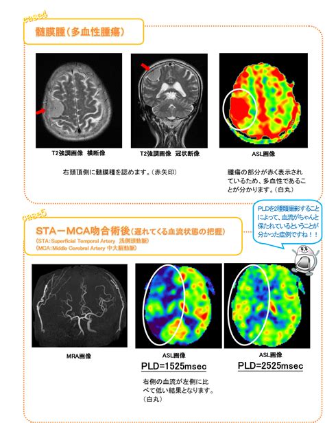 MRI Radiology Home