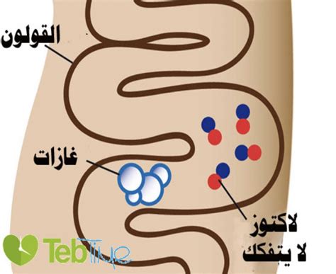 في هذه السلسلة 🔸هل سمعت بمصطلح عدم تحمل سكر الحليب Lactose Intolerance