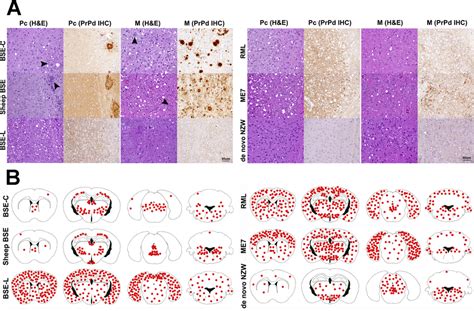 A Histopathological Characterization Of Several Prion Strains In Tgrab