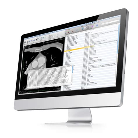 Osirix Dicom Viewer Osirix Md