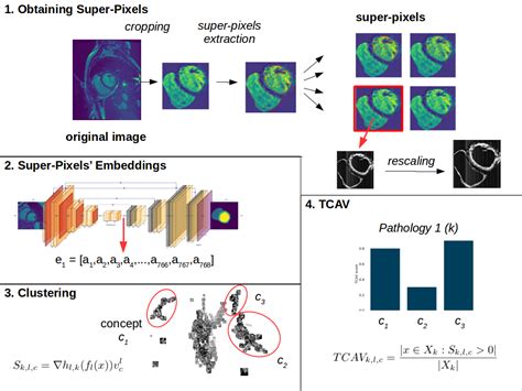 interpretability of a deep learning model in the application of cardiac