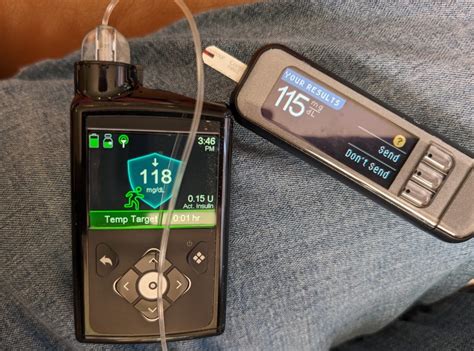 Revolutionize Your Routine Top 5 Insulin Pump Tips For A Hassle Free Life Insulin Pump Life