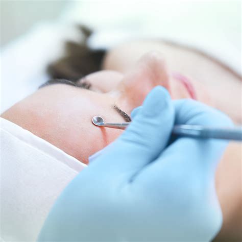 Oily Skin Why You Will Benefit Most From Extraction Facials Caring Skin