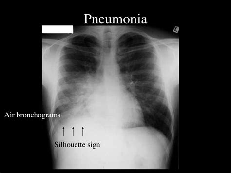 Ppt “what Test Is Best” Choosing Radiology Exams In Emergency