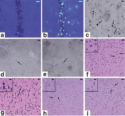 Figure 1 From Neurodegeneration In Alzheimer S Disease Signaling May Be Involved In Complement