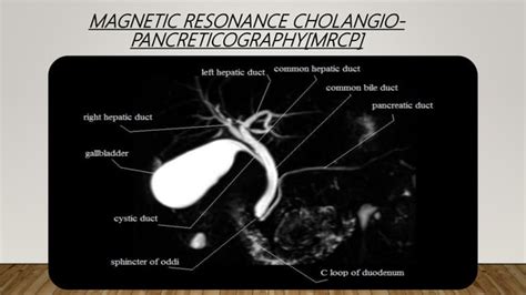 Radiological Anatomy Of Biliary System Pptx