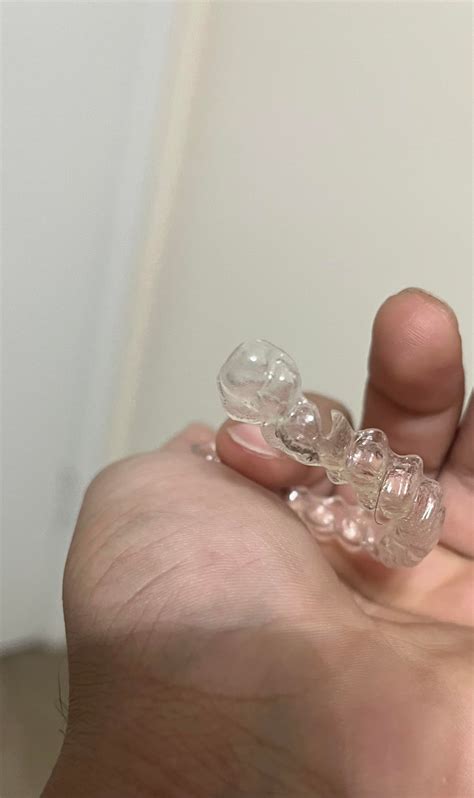 Was I Supposed To Wear 3 Elastics R Invisalign