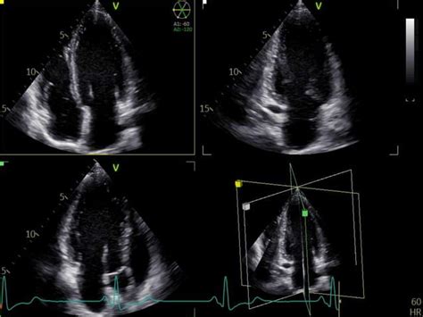 Lv Systolic Functionpptx 3 D Graphics Computer Software And Applications