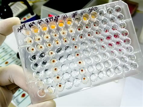 Test Elisa Co To Jest Na Czym Polega Warianty Cena I Kiedy Wykonać