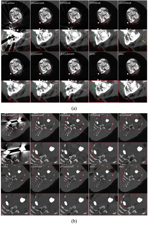 Qualitative Comparison Of Different Methods On The Synthetic Dataset Download Scientific