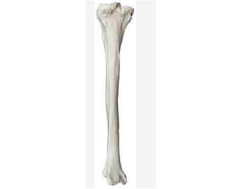 Tibia Bone Identification Quiz