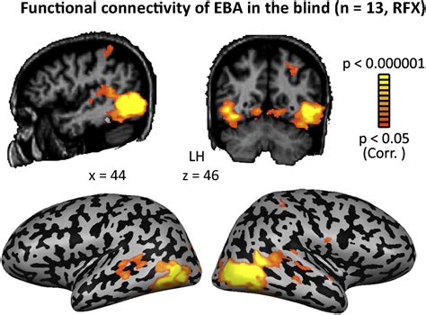 Extrastriate Visual Cortex