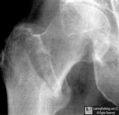 RADIOLOGY PREGNANCY INFECTION AND TREATMENT