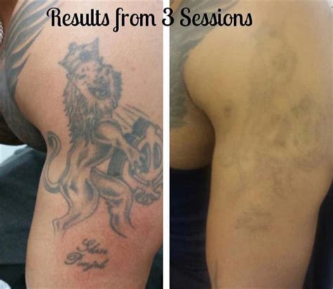 What Is Picosecond Mihoji Electronic Technology