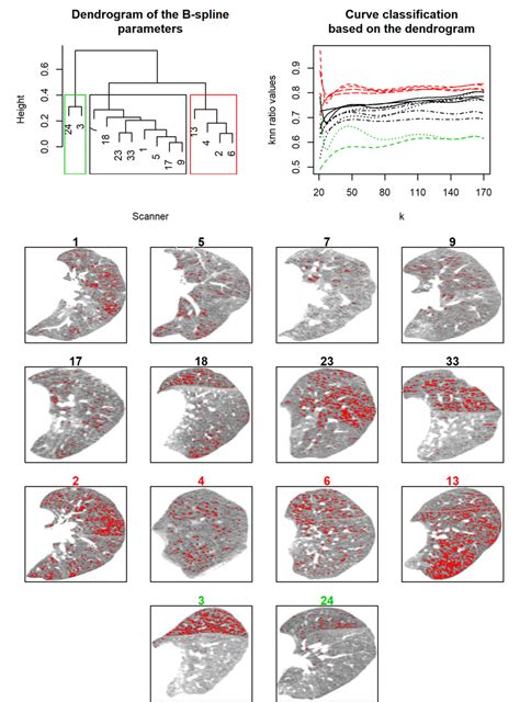 Figure 1 From K Nearest Neighbor Curves In Imaging Data Classification Semantic Scholar