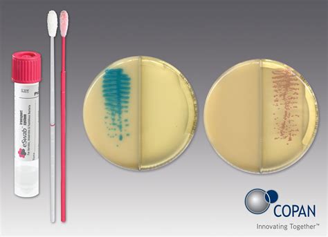 Chromogenic Bi Plates And Dual Eswab™ Processed On Wasplab® Cuts Number Of Specimens And Plates