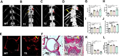 Early Pharmacological Blockade Of The Cxcl12 Cxcr4 Axis Attenuates