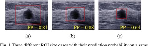 Figure 1 From Weakly Supervised Lesion Detection And Diagnosis For