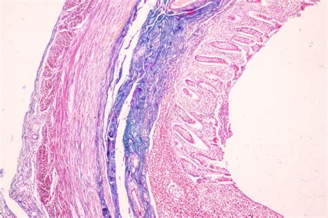 Small Intestine Duodenum And Vermiform Appendix Human Under The Microscope Stock Image Image