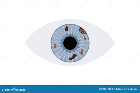 Iris Melanoma Anatomy Vector Illustration 329619320